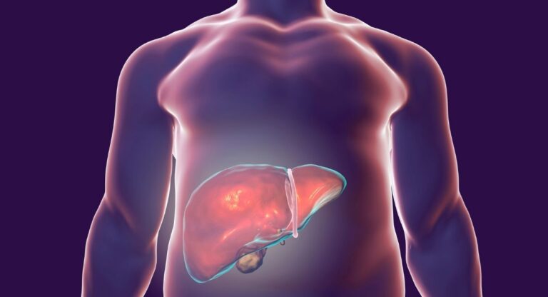 9 Síntomas de problemas hepáticos