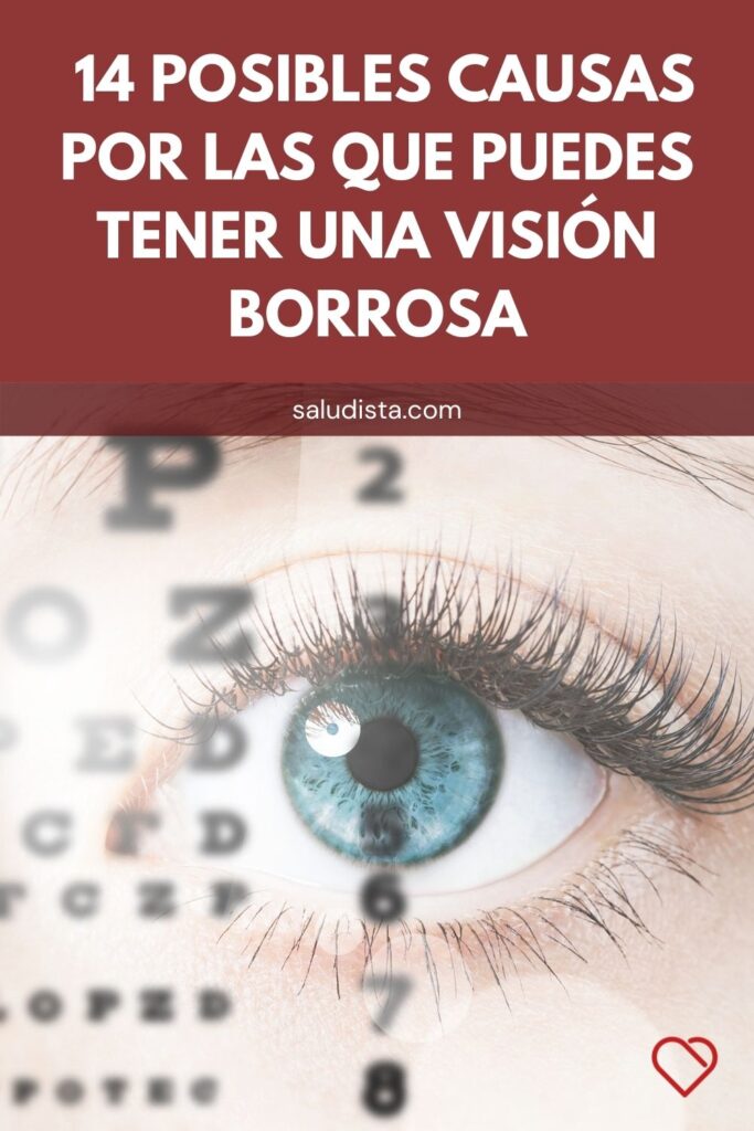 14 Posibles causas por las que puedes tener una visión borrosa